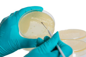 Microbial Limits Test - Pacific BioLabs